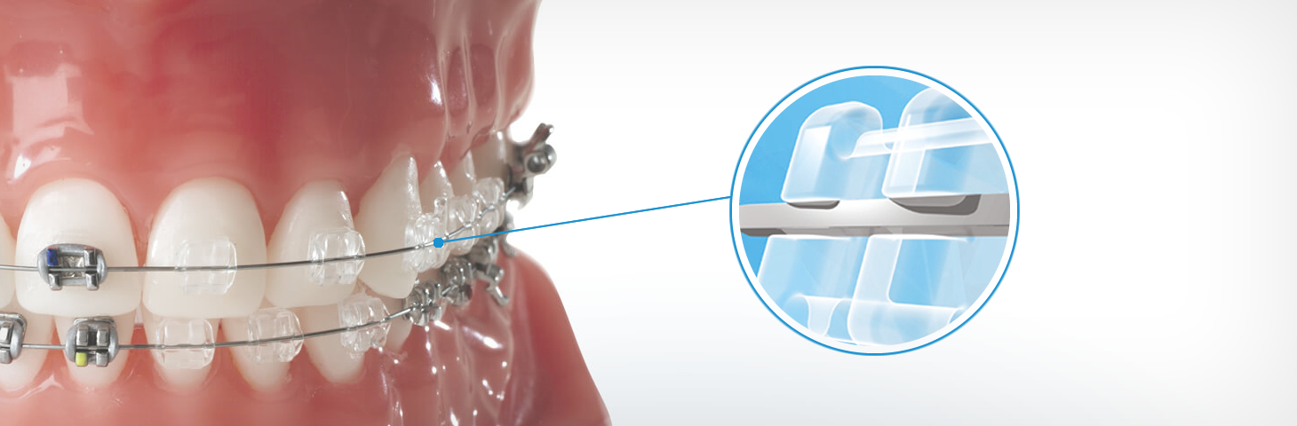 ICE_BLOQUE_2_RESPONSIVE | Ormco