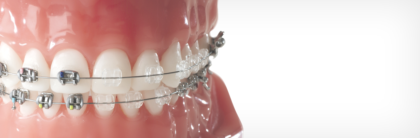 ICE_RESPONSIVE_BLOQUE_2 | Ormco